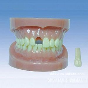 Removable and rootless Standard tooth modelADA MED SUPPLY LIMITED