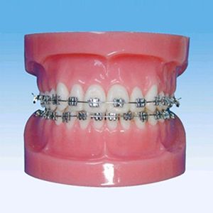 Fixed rectify teeth model (normal)ADA MED SUPPLY LIMITED